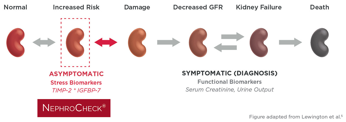 The NEPHROCHECK® Test